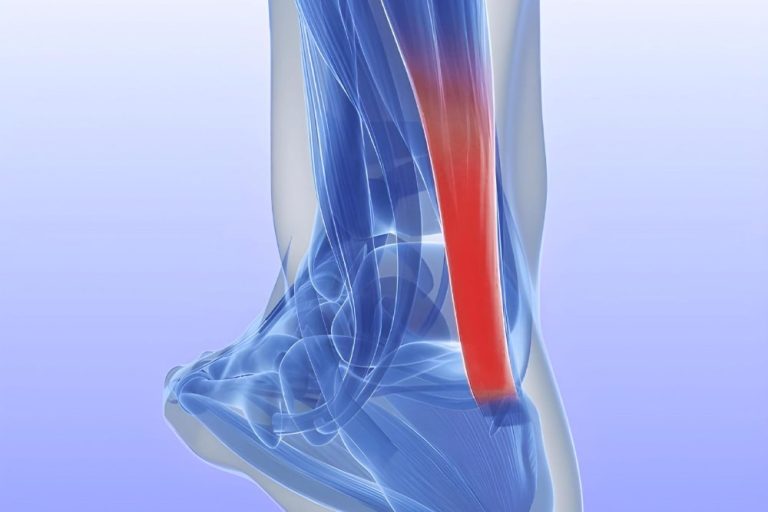 Callus vs. Corn vs. Bunion: What are the Differences?